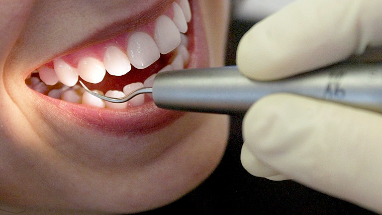 Wissenswertes über Zähne - Zähne - Sie können viel mehr als beißen ...